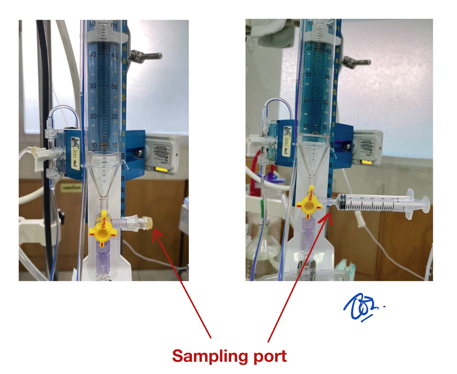 การดูแล ventriculostomy (EVD) เบื้องต้นสำหรับ Non-neurosurgeon ...